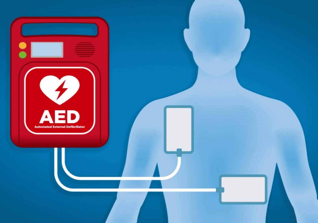 AED Device Explained: How This Device Restarts the Heart - Shriyo Ventures